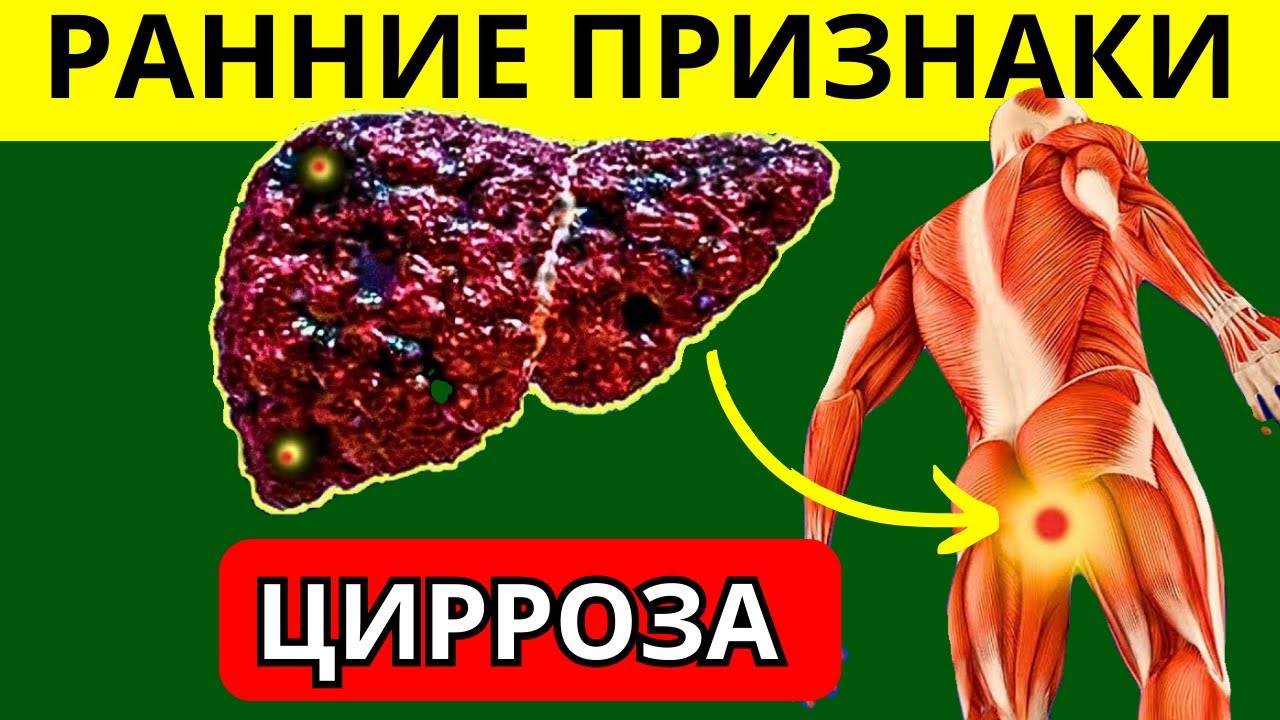 ВАША ПЕЧЕНЬ В ОПАСНОСТИ 12 Ранних Признаков Цирроза Печени Youtube
