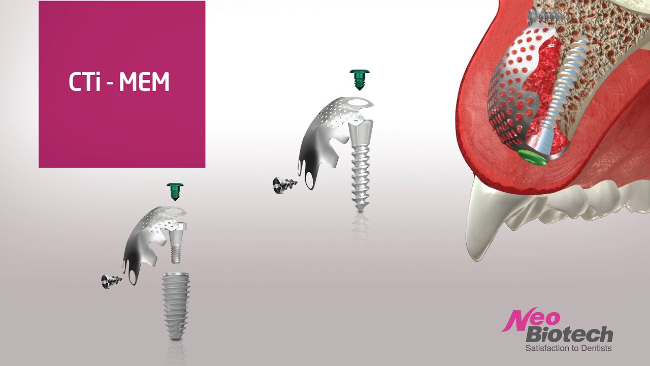 Neobiotech CTi mem - YouTube