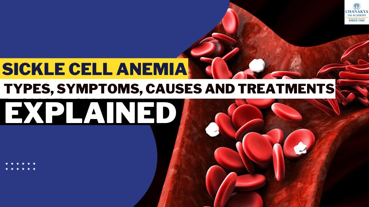 Sickle Cell anemia – Types, Symptoms, Causes And Treatments | Science ...