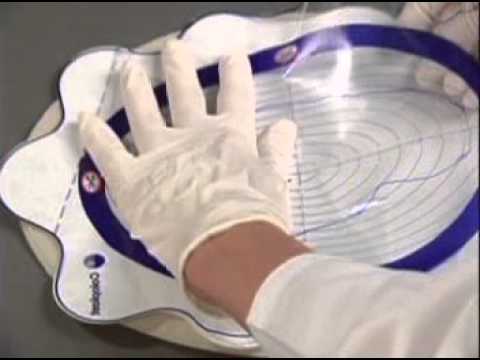Coloplast Fistula English - YouTube