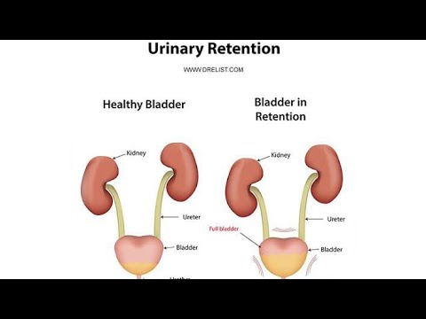 Using Muscarinic Agonists to Treat Bladder Urine Retention - YouTube