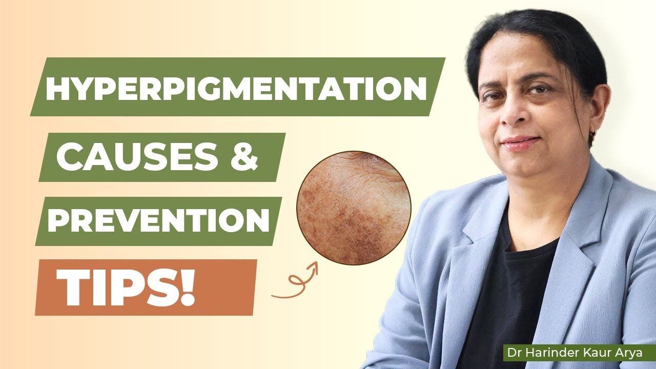 Understanding Hyperpigmentation: Causes, Prevention, and Results - YouTube