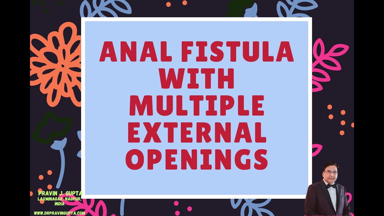 ANAL FISTULA WITH MULTIPLE EXTERNAL OPENINGS - YouTube