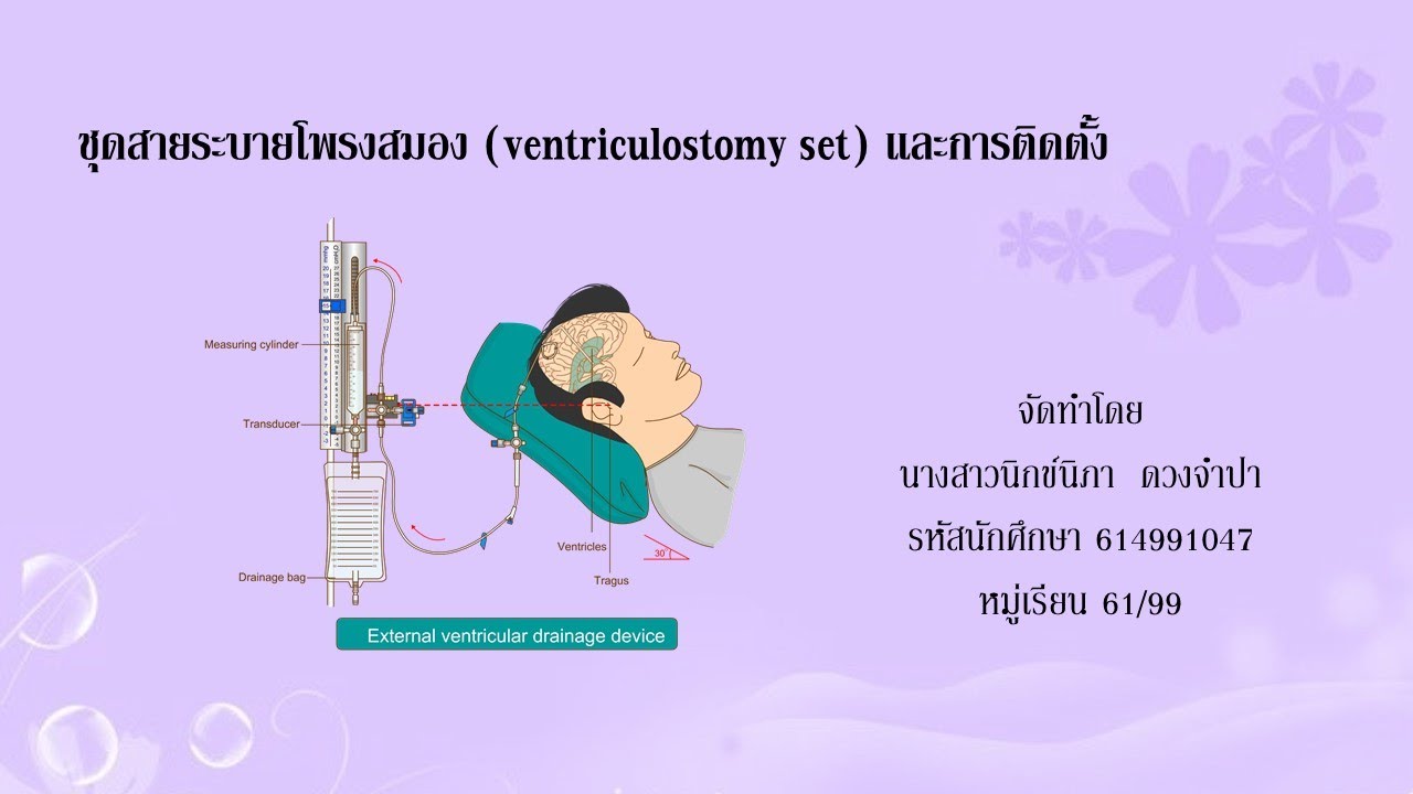 ชุดสายระบายโพรงสมอง (ventriculostomy set) - YouTube