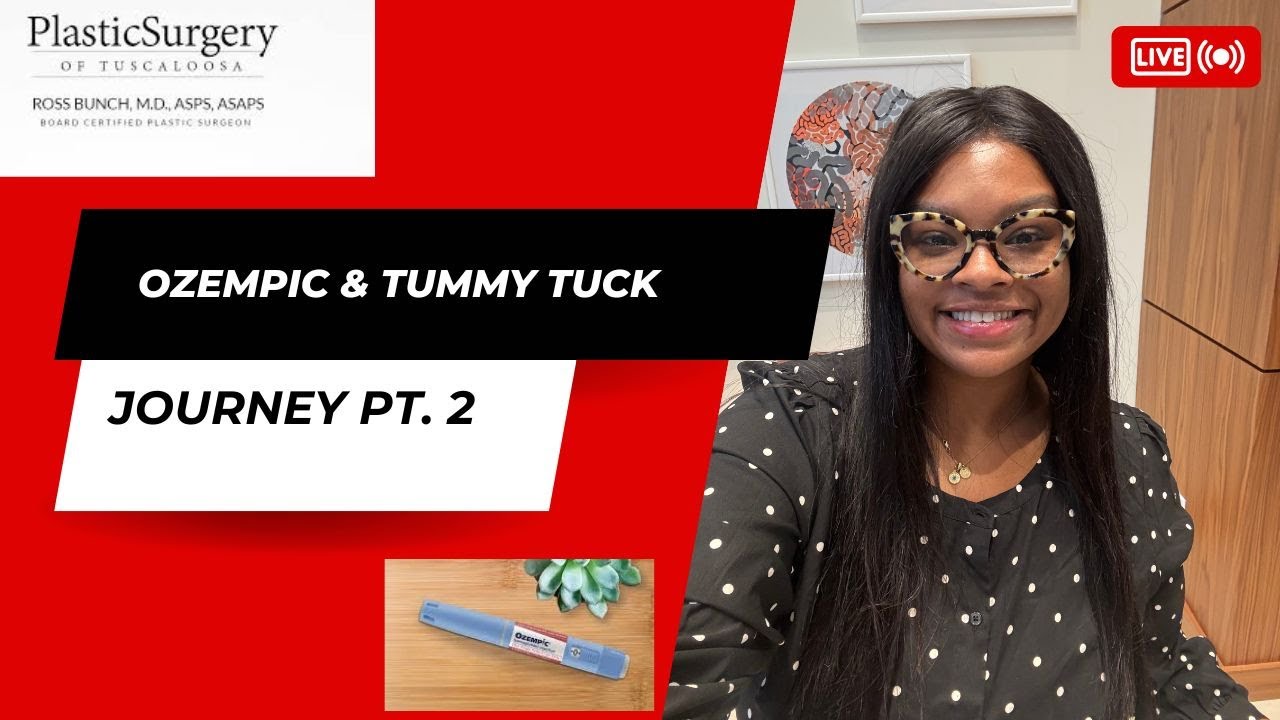 Ozempic & Tummy Tuck Journey & High BMI Tummy Tuck & Lipo w. Dr. Ross E ...
