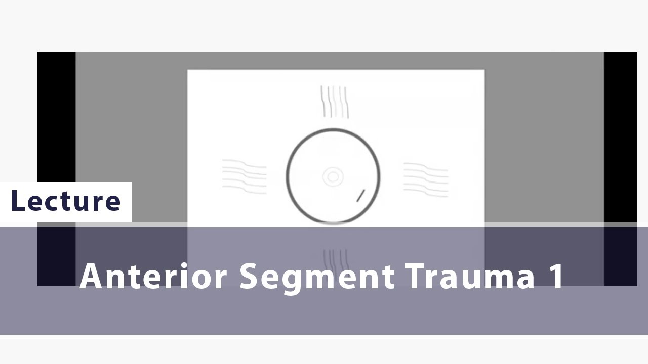 Anterior Segment Trauma 1 - YouTube