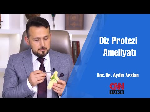 Diz Protezi Ameliyatı | İşin Uzmanı Doç. Dr. Aydın Arslan