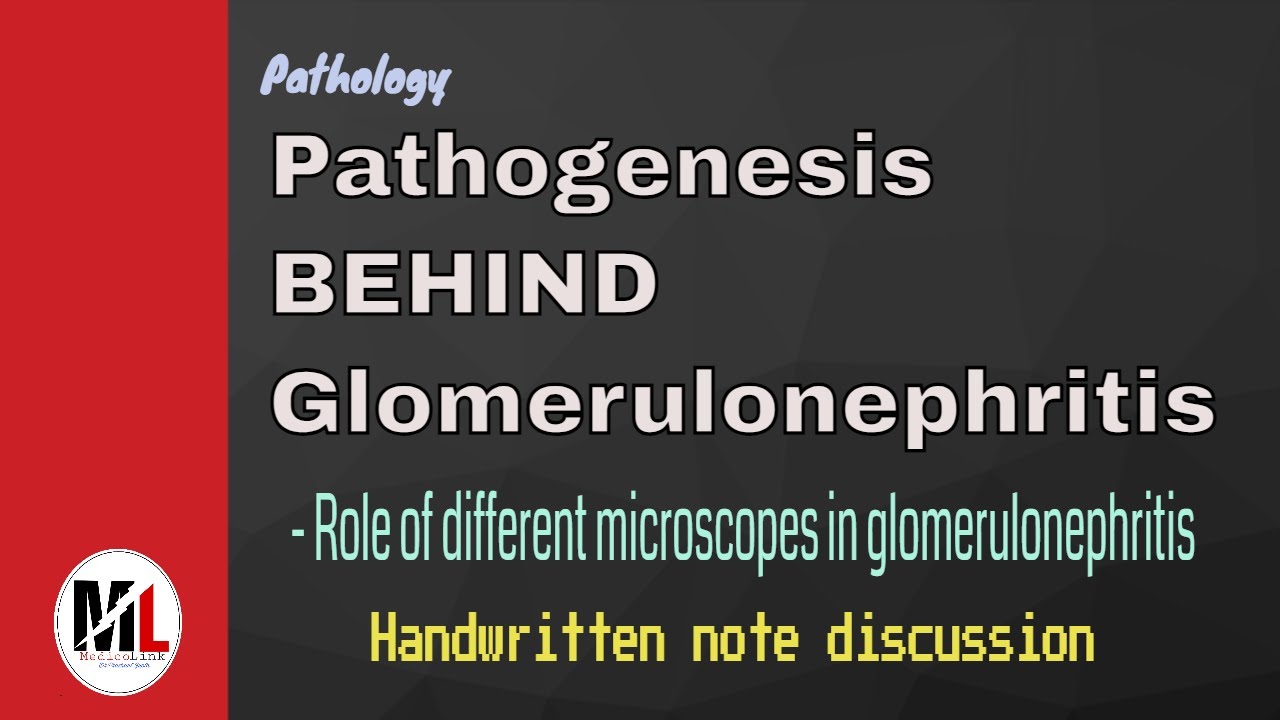 Glomerulonephritis and Its Pathogenesis/ Role of different microscopes ...