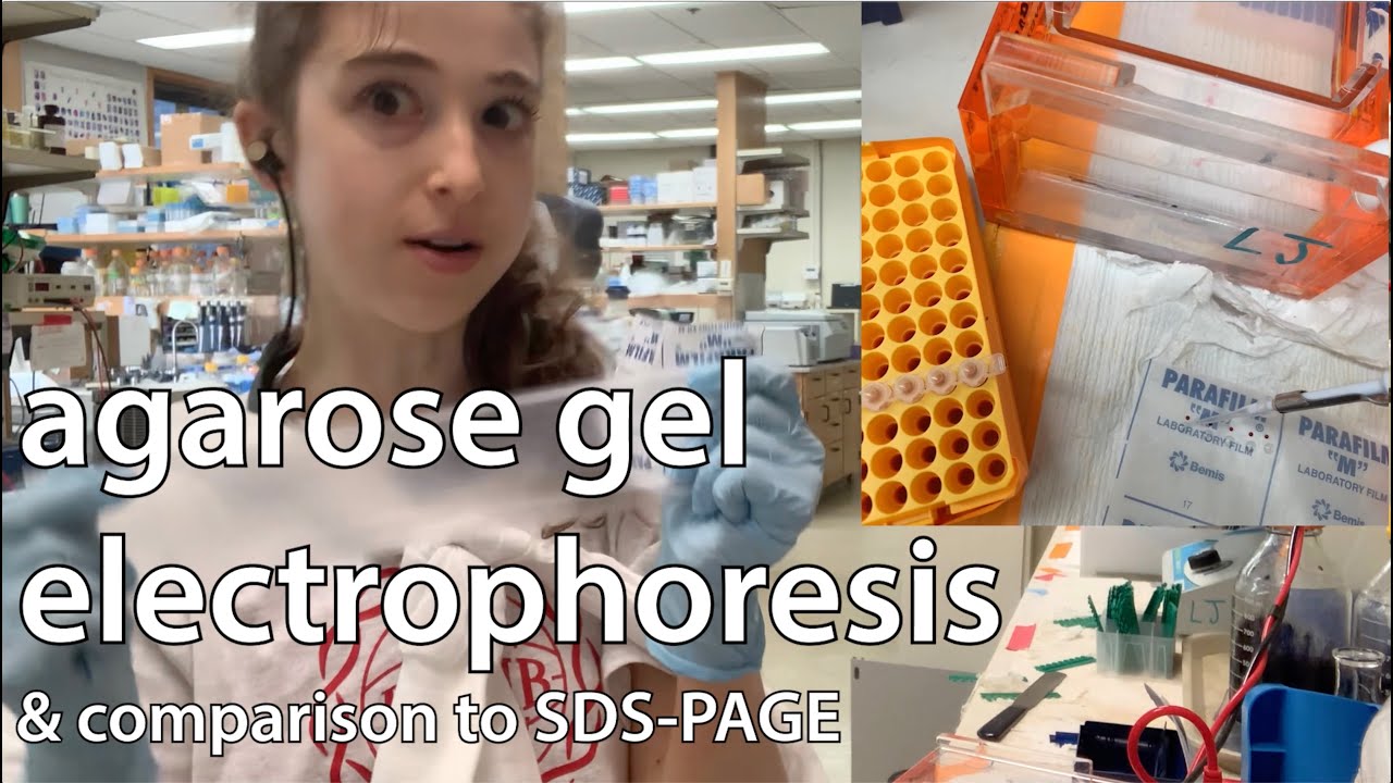 Difference Between Sds Page And Agarose Gel Electrophoresis ...