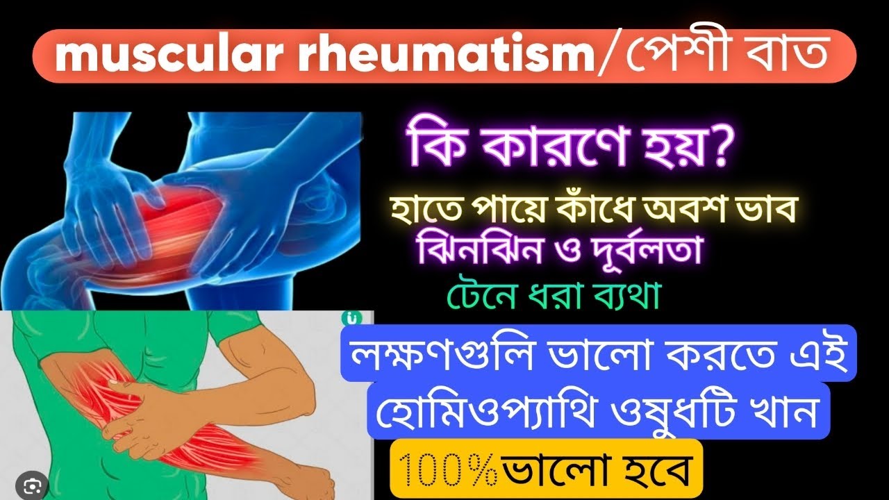 Muscular rheumatism/পেশী বাত কি কারনে হয়?লক্ষণ কি? সমস্যা টি ভালো করার ...