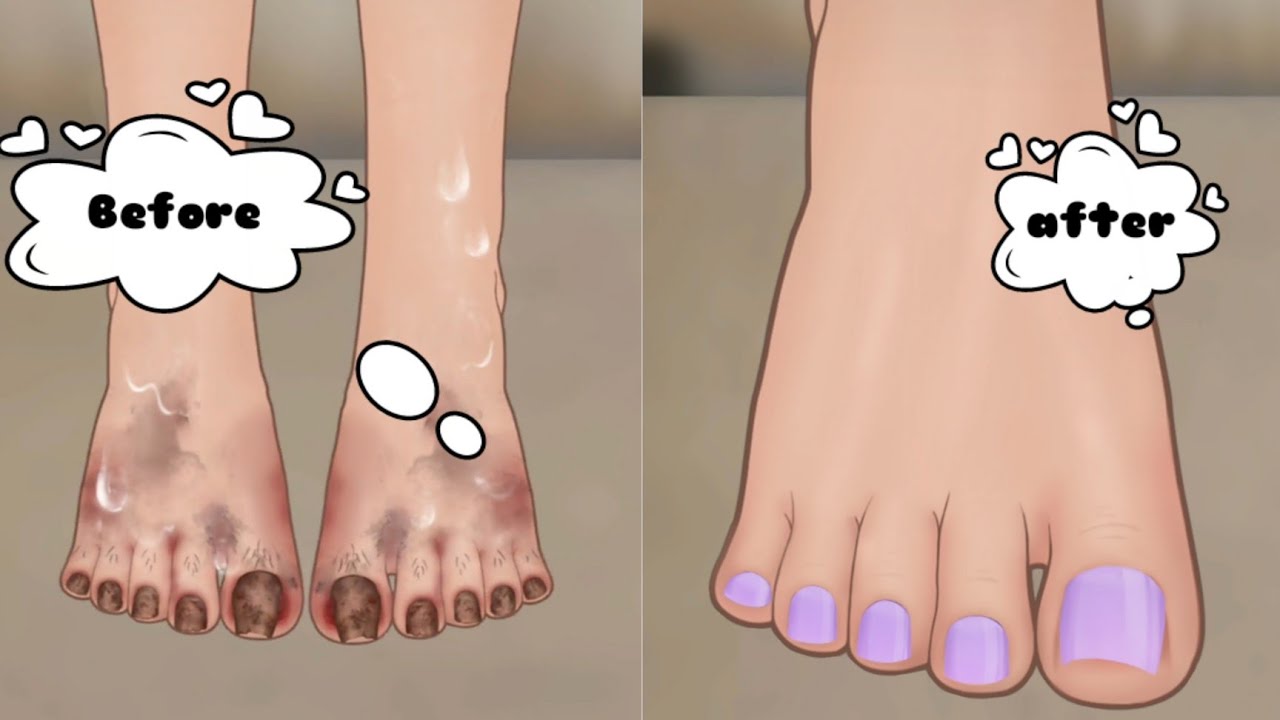 Asmr relaxing pedicure animation| cleaning dirty foot treatment Asmr ...