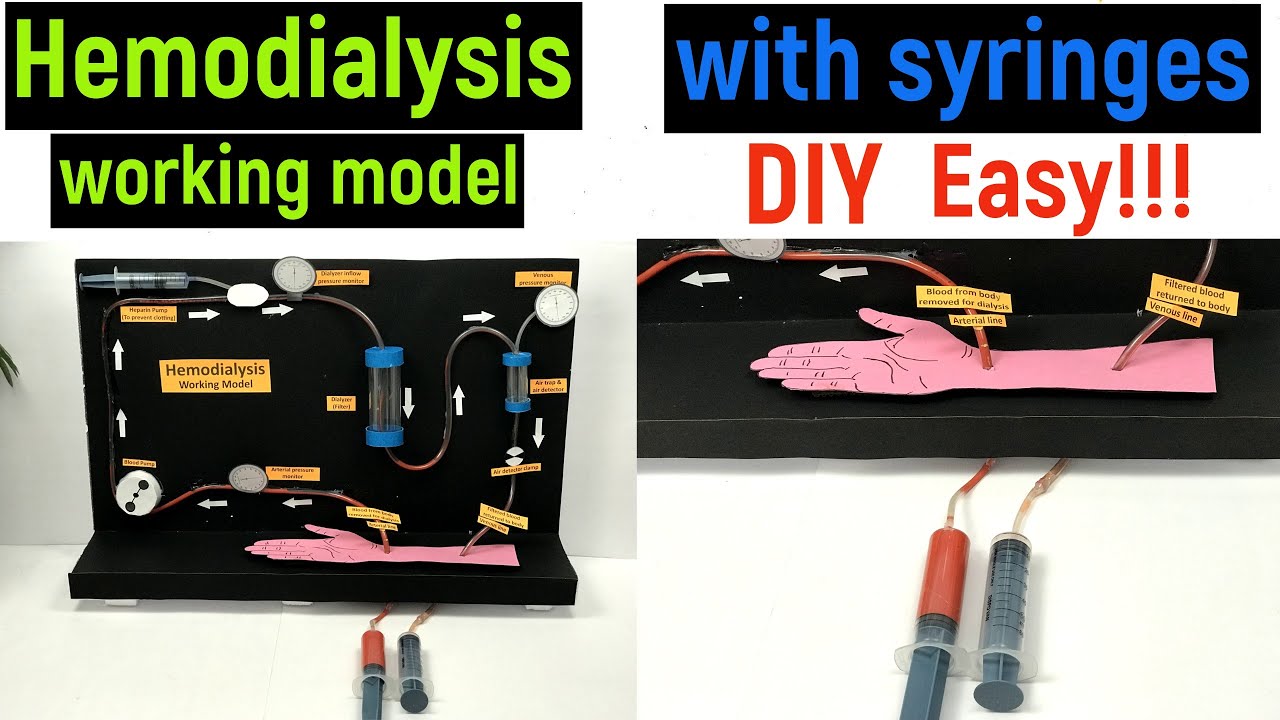 hemodialysis working model - hemodialysis working model with syringes ...