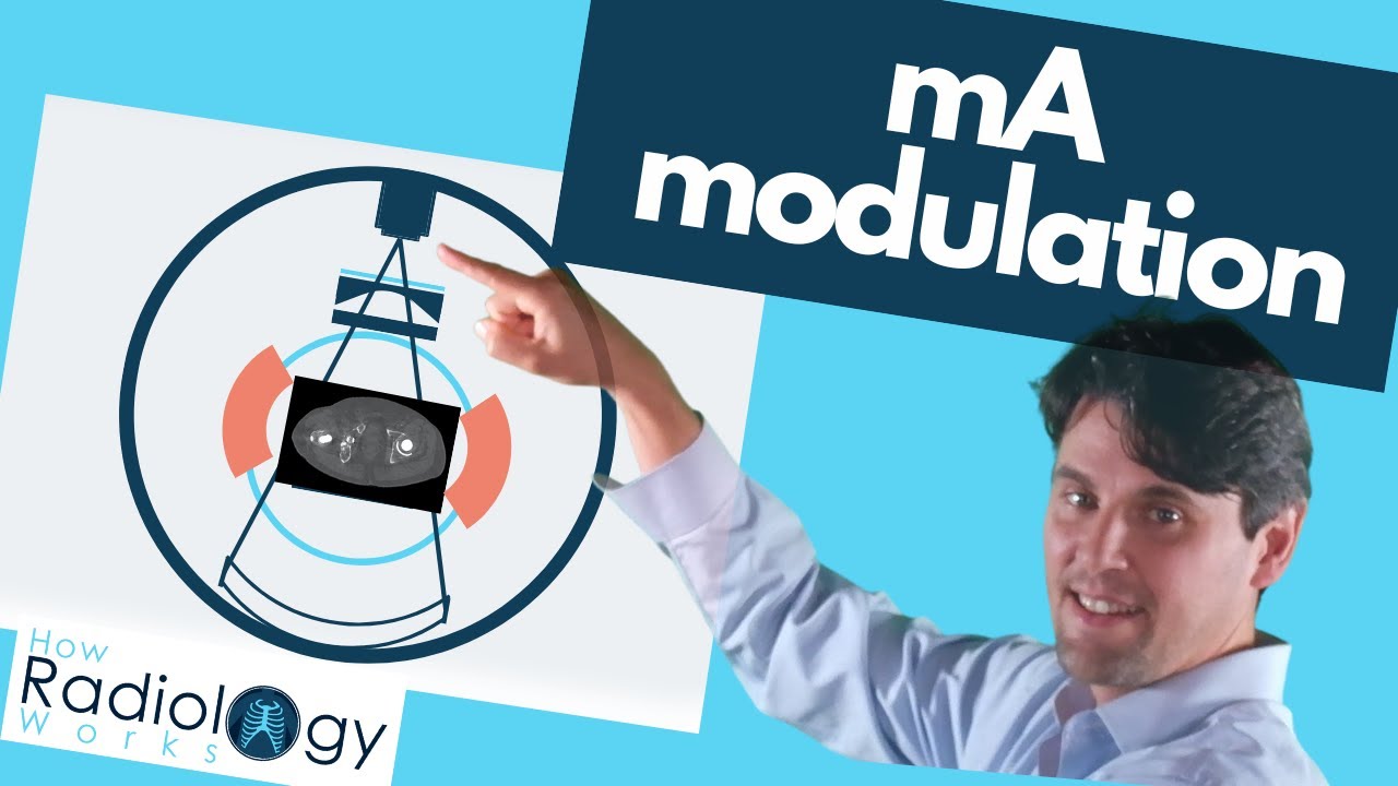 Tube Current Modulation (CT Physics) - YouTube