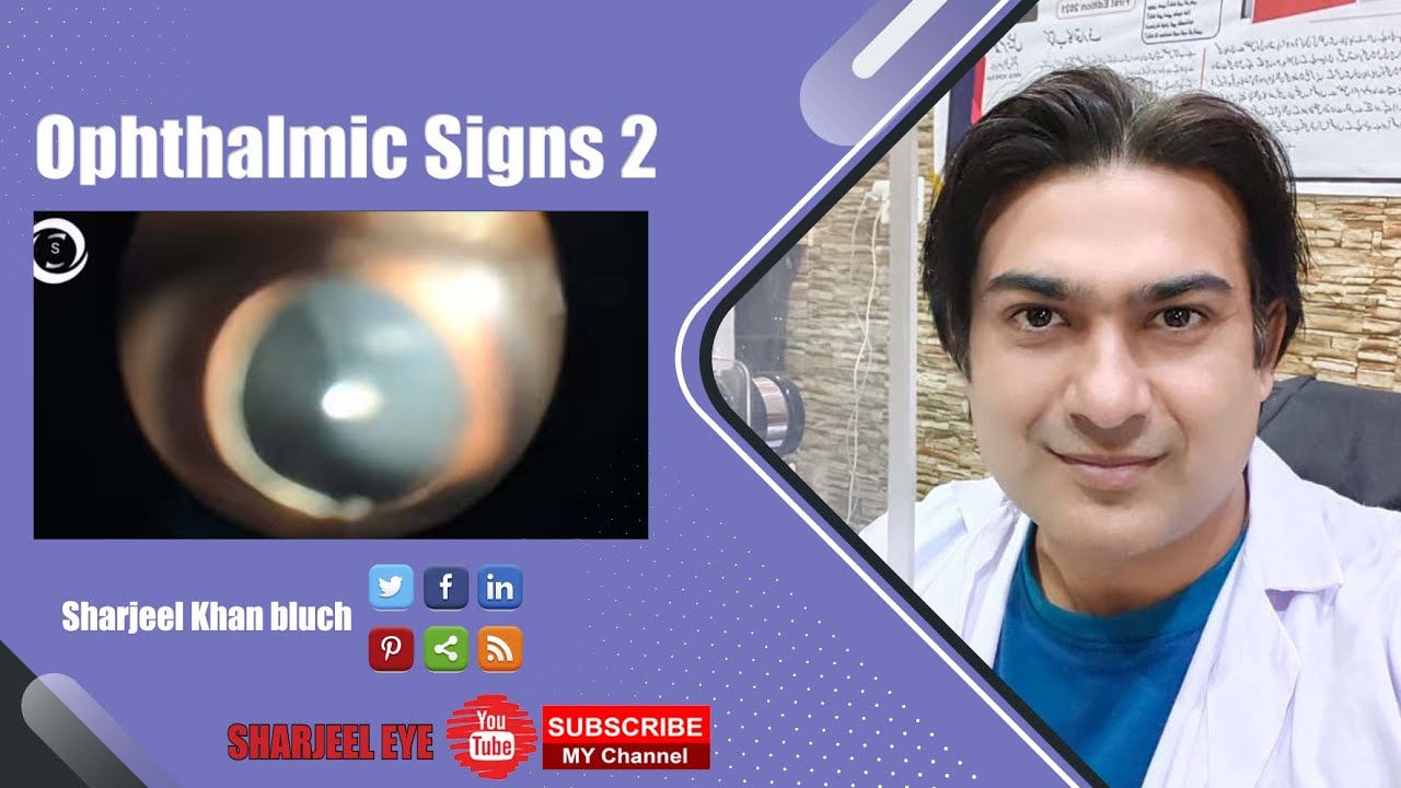 Ophthalmic Signs 2 - YouTube