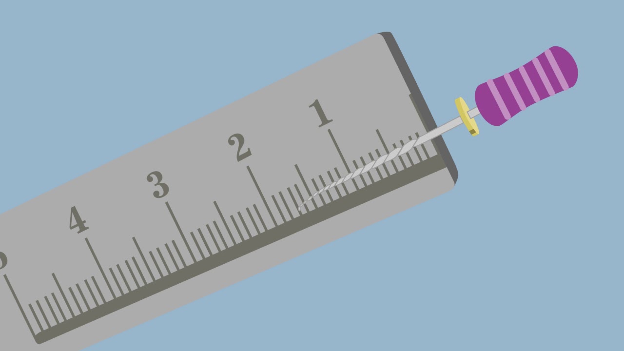 Endodoncia B1 Conductometria - YouTube