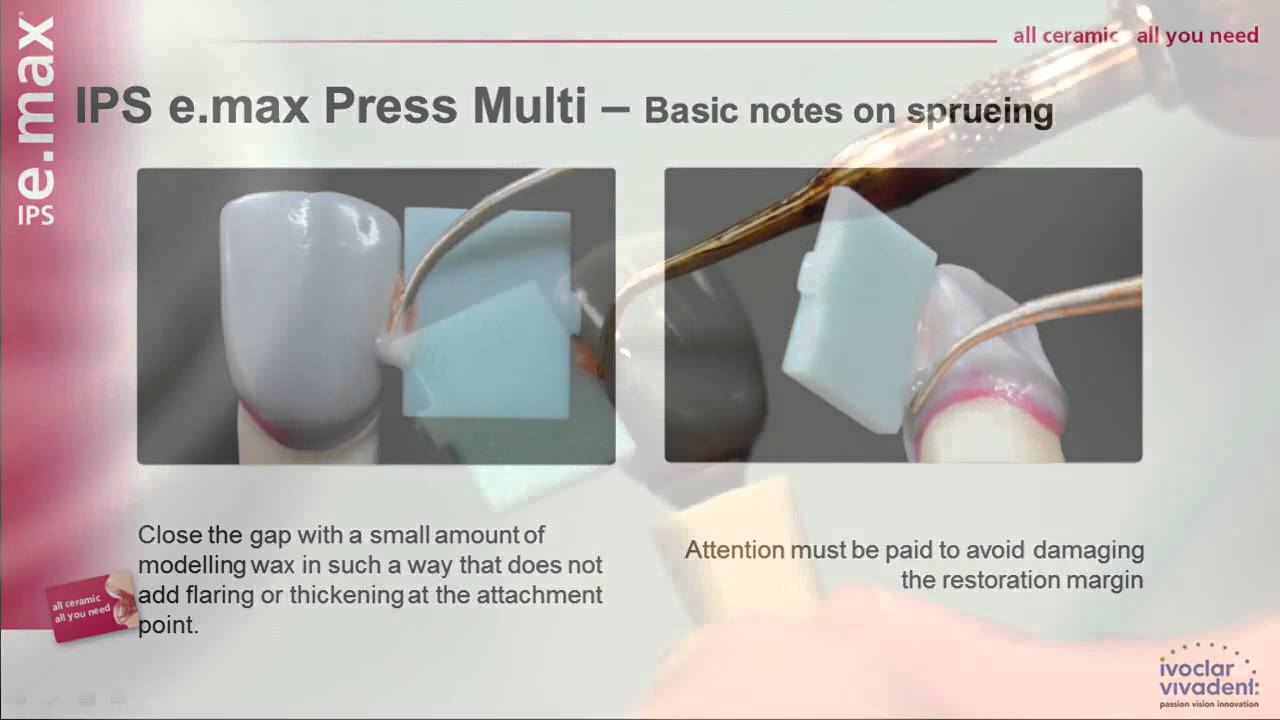 Introducing IPS e max® Press Multi - YouTube