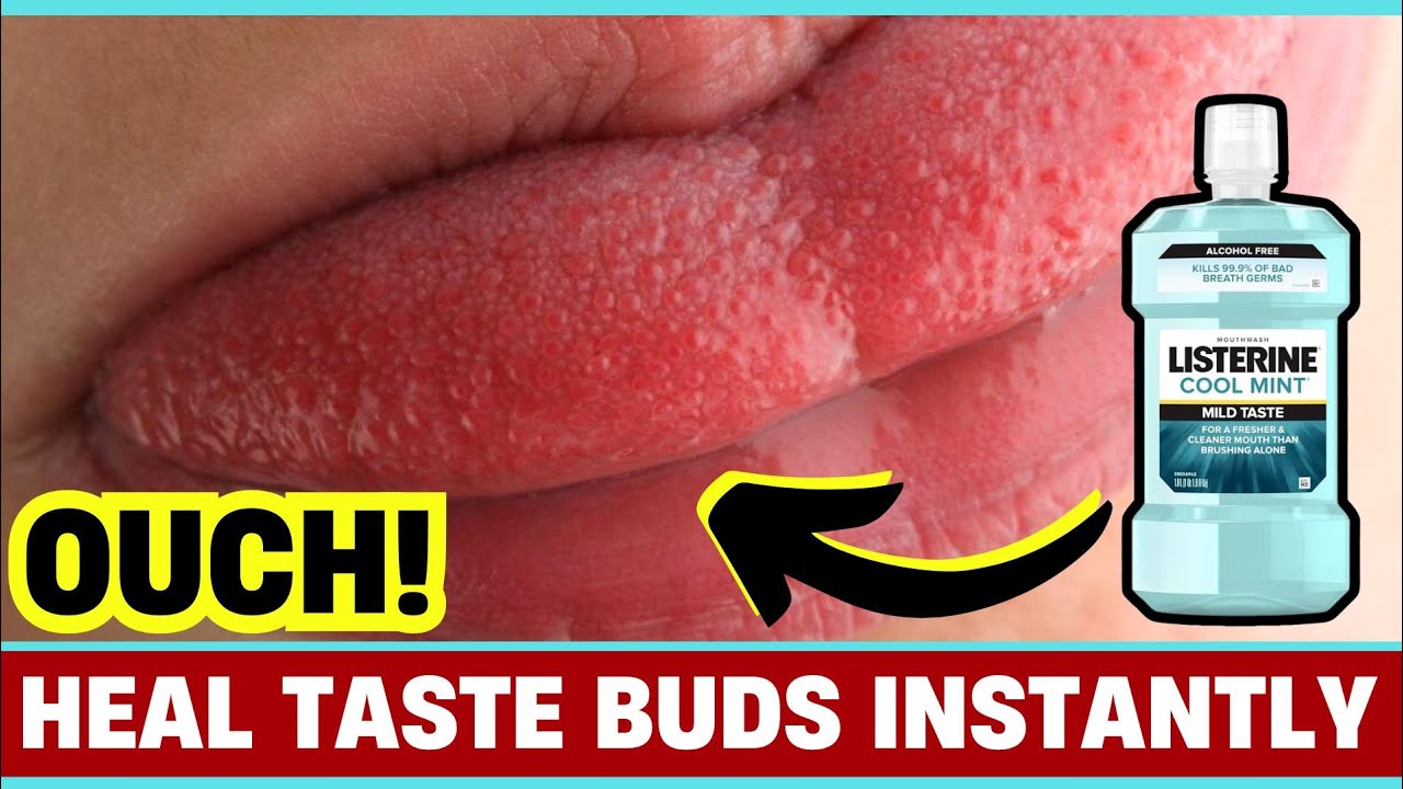 Swollen Taste Buds? Do THIS to Fix It Instantly! - YouTube