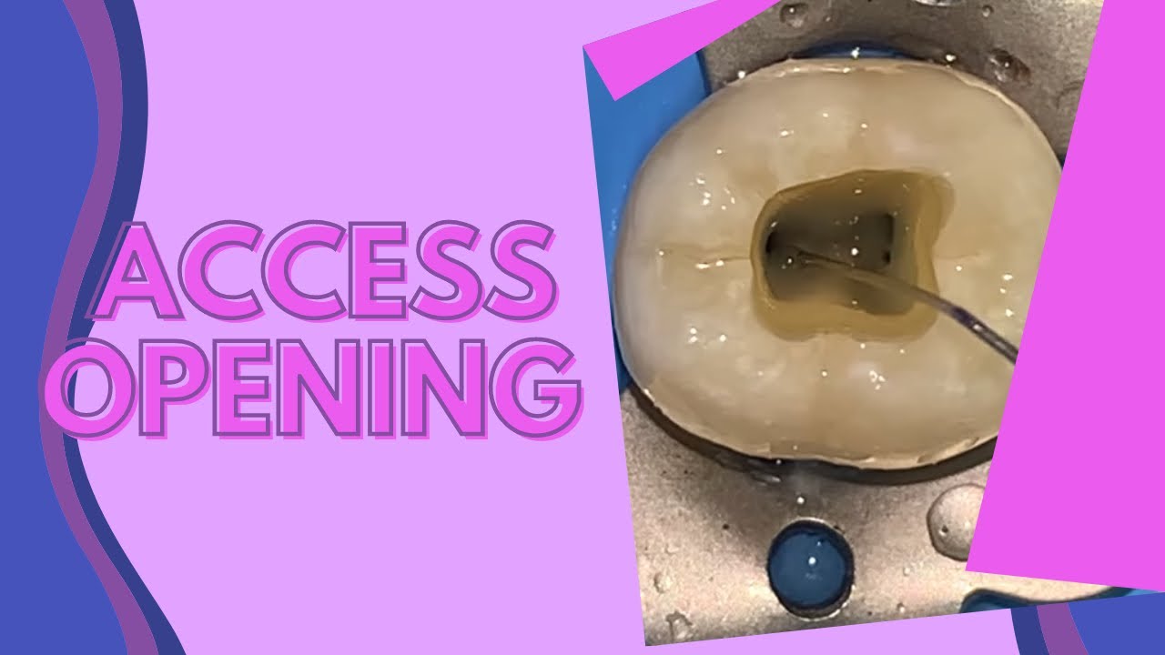 Access Opening No. 38 - YouTube