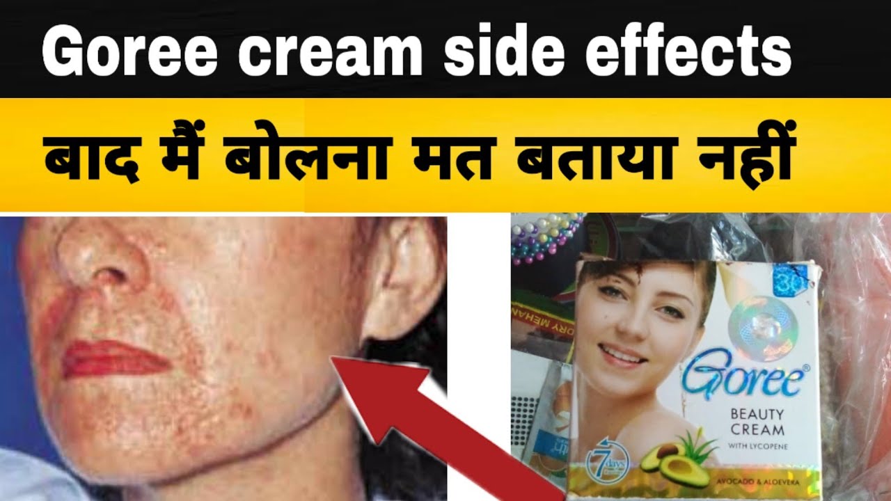 Goree Beauty cream side effects, Benefits, original fake Goree, Goree ...