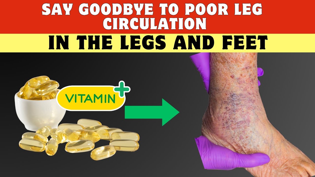 EXCLUSIVE: The #1 MUST-HAVE Vitamin for Poor Leg Circulation! - YouTube