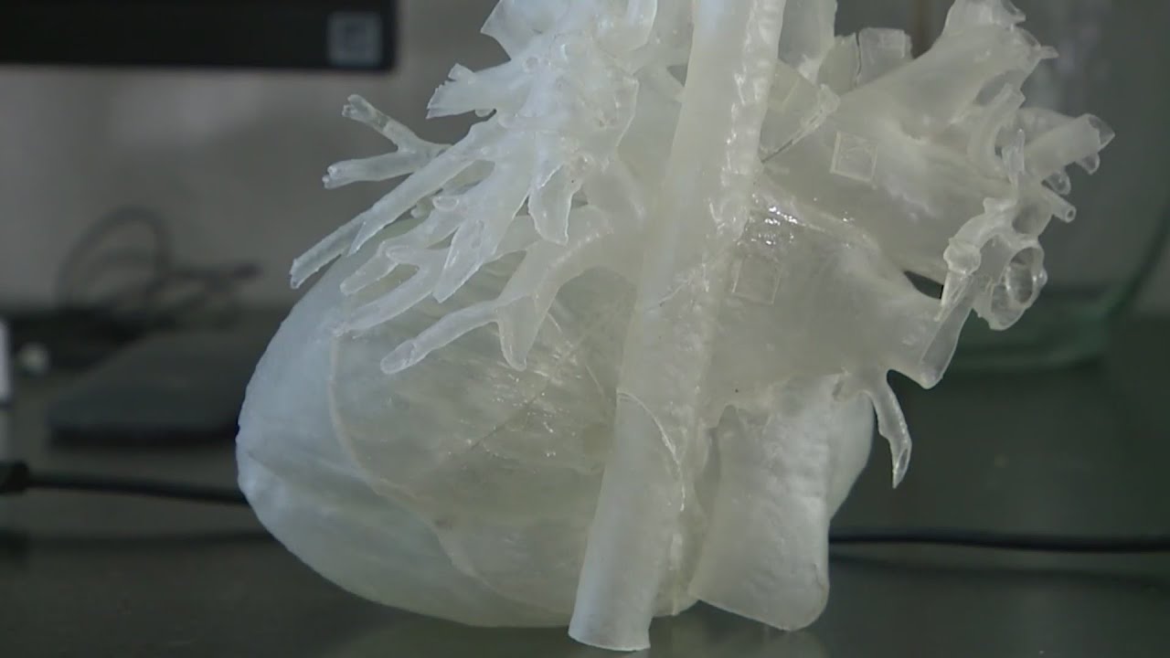 Colorado man receives first of its kind heart procedure - YouTube