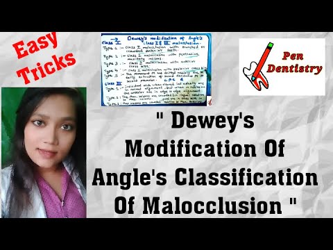 Dewey's modification of angle classification By#PenDentistry#doctor# ...
