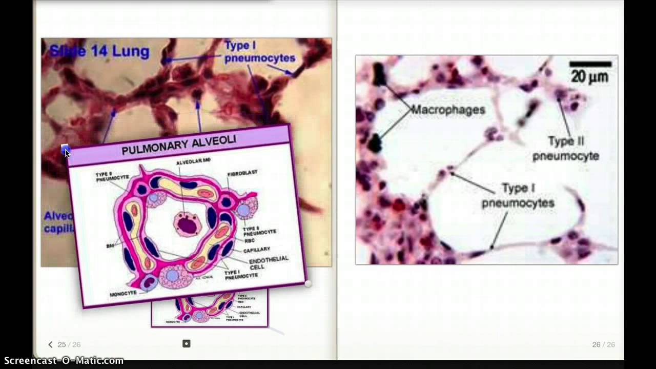 PNEUMOCYTES : PG 559 FA 12 - YouTube