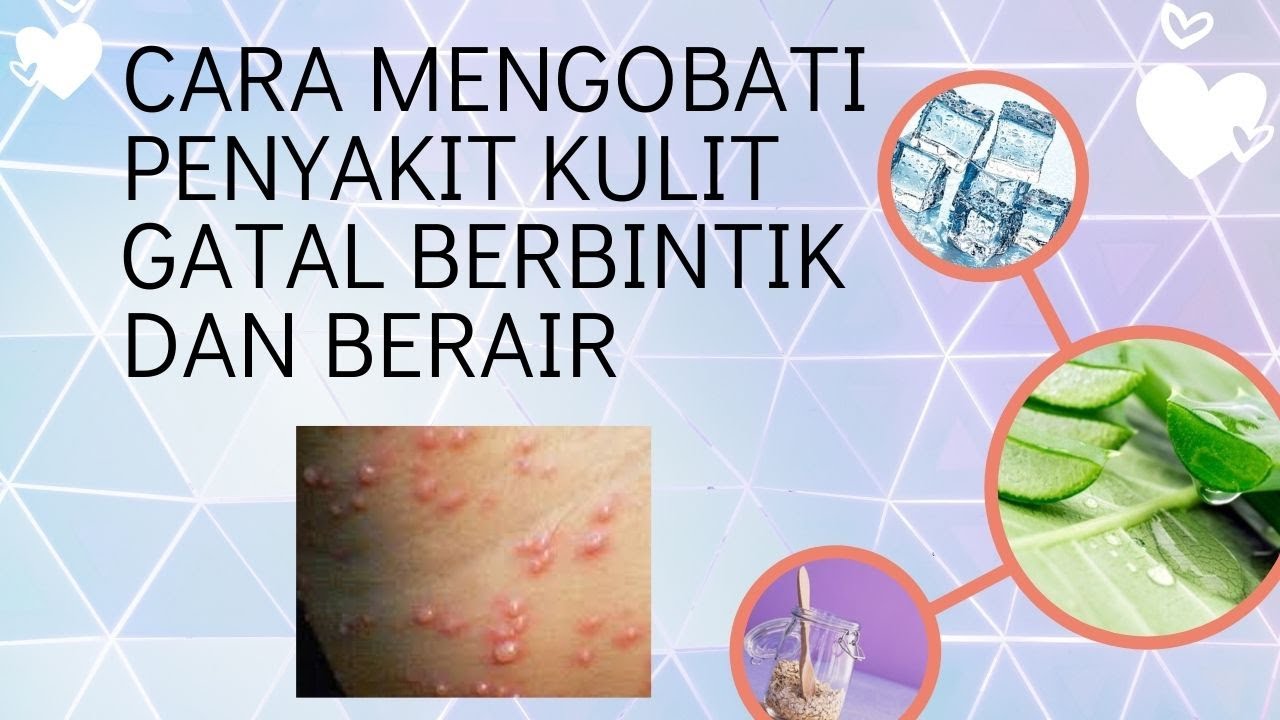 Cara Mengobati Penyakit Kulit Gatal Berbintik Dan Berair - YouTube