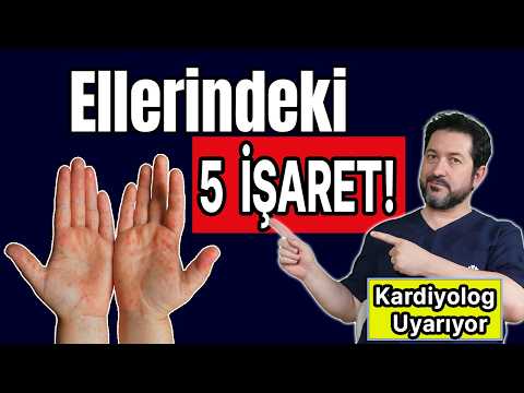 Elindeki Bu 5 İşarete Dikkat! Kalp Yetmezliği Belirtileri