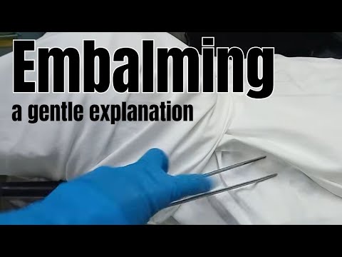 How we embalm a body in the mortuary gentle