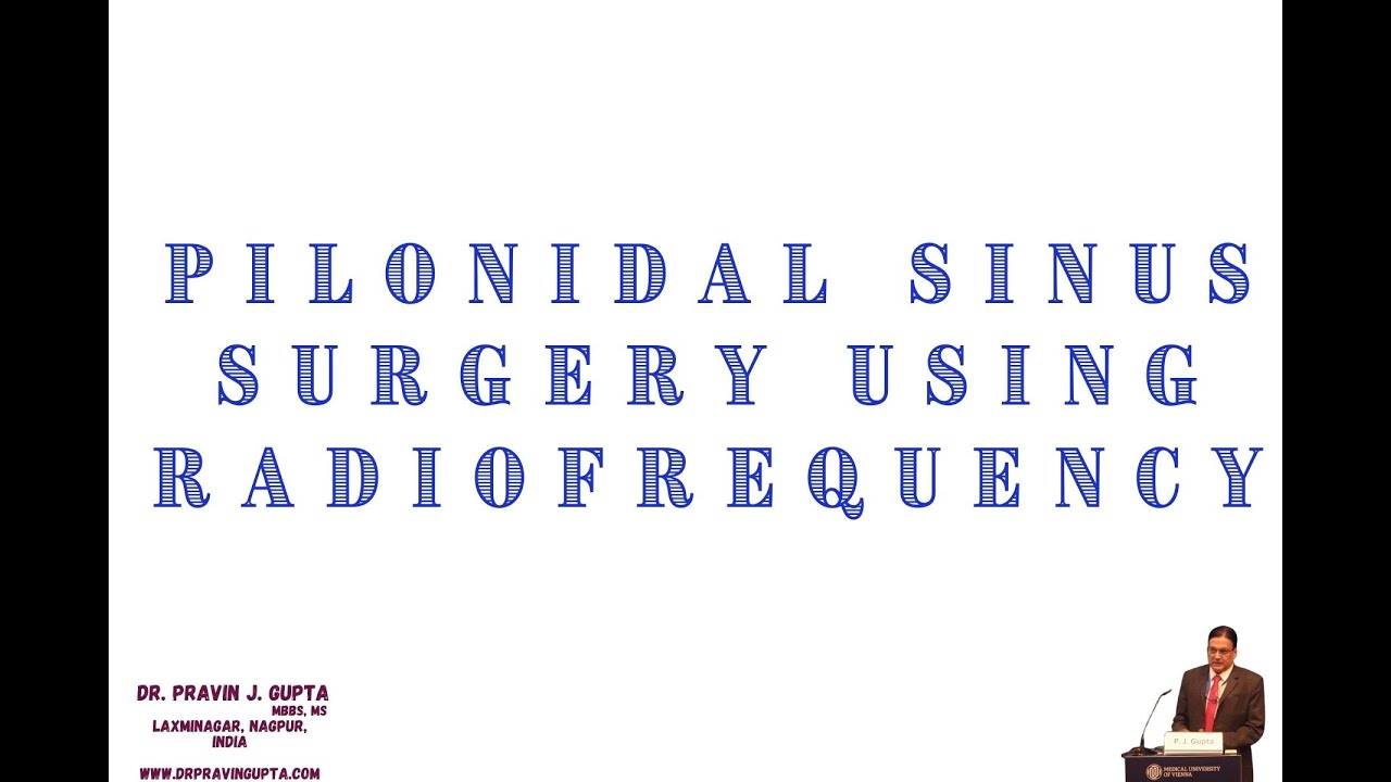 PILONIDAL SINUS SURGERY USING RADIOFREQUENCY - CIRUGÍA DEL SENO ...