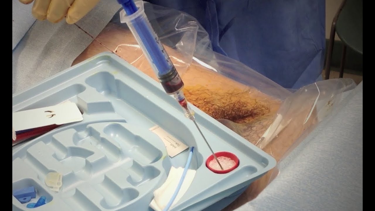 central line - YouTube