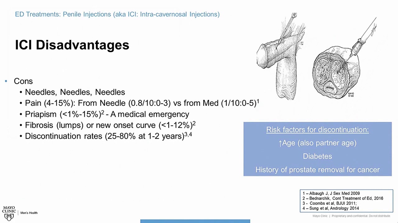 Penile Injection for Erectile Dysfunction Treatment - YouTube