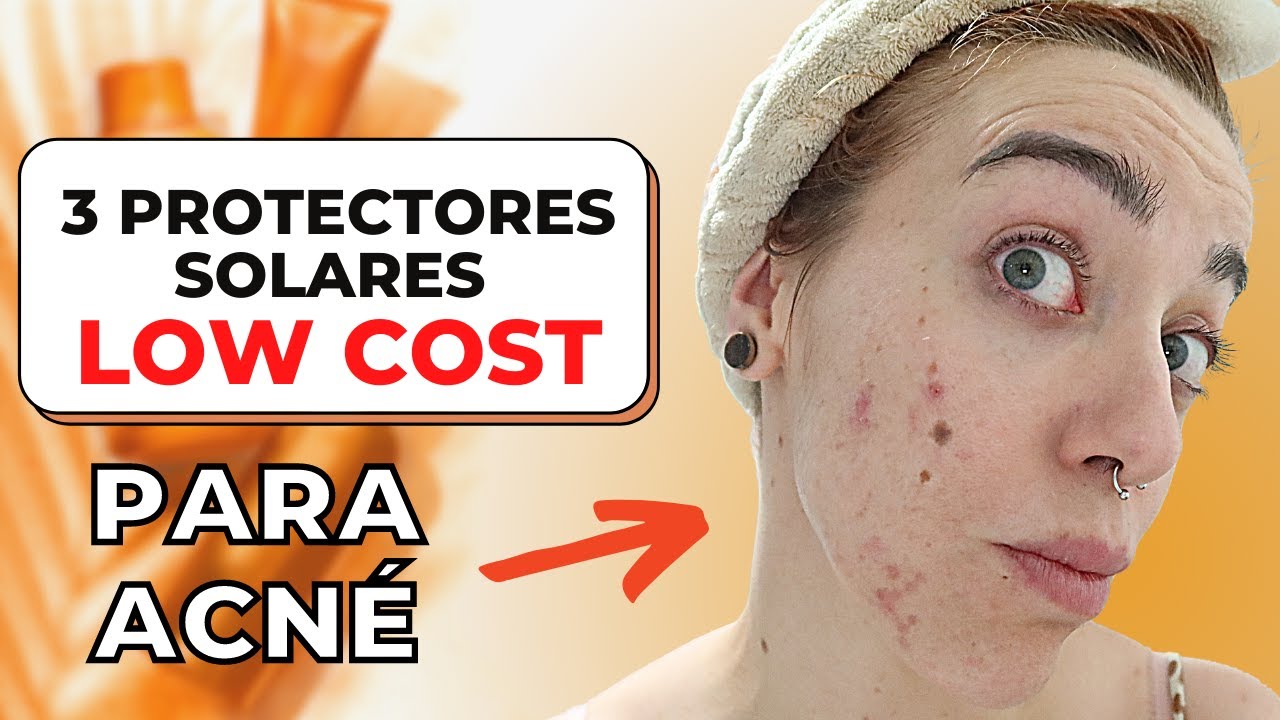 3 MEJORES protectores solares LOW COST para ACNÉ ️ [usa ESTO si tienes ...