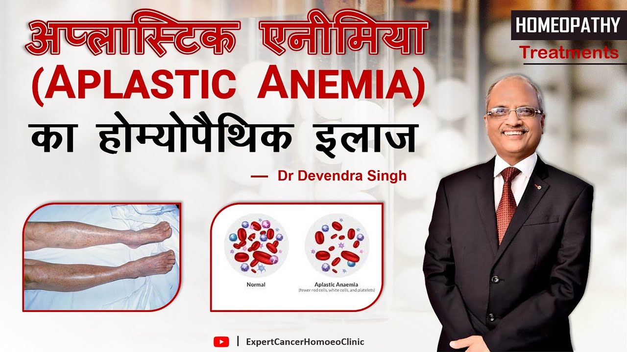 How Aplastic anemia patient survived for 25 years ? - must watch video ...