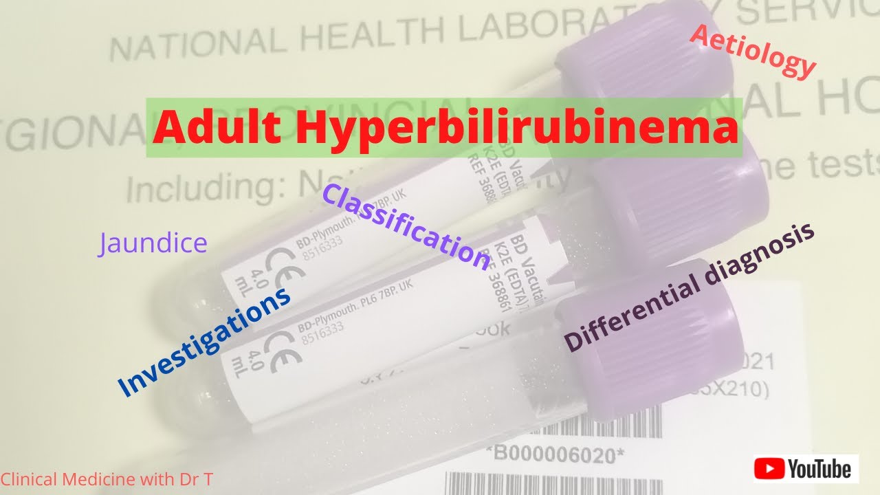 Adult Hyperbilirubinemia/Jaundice/Classifications/Investigations/ - YouTube