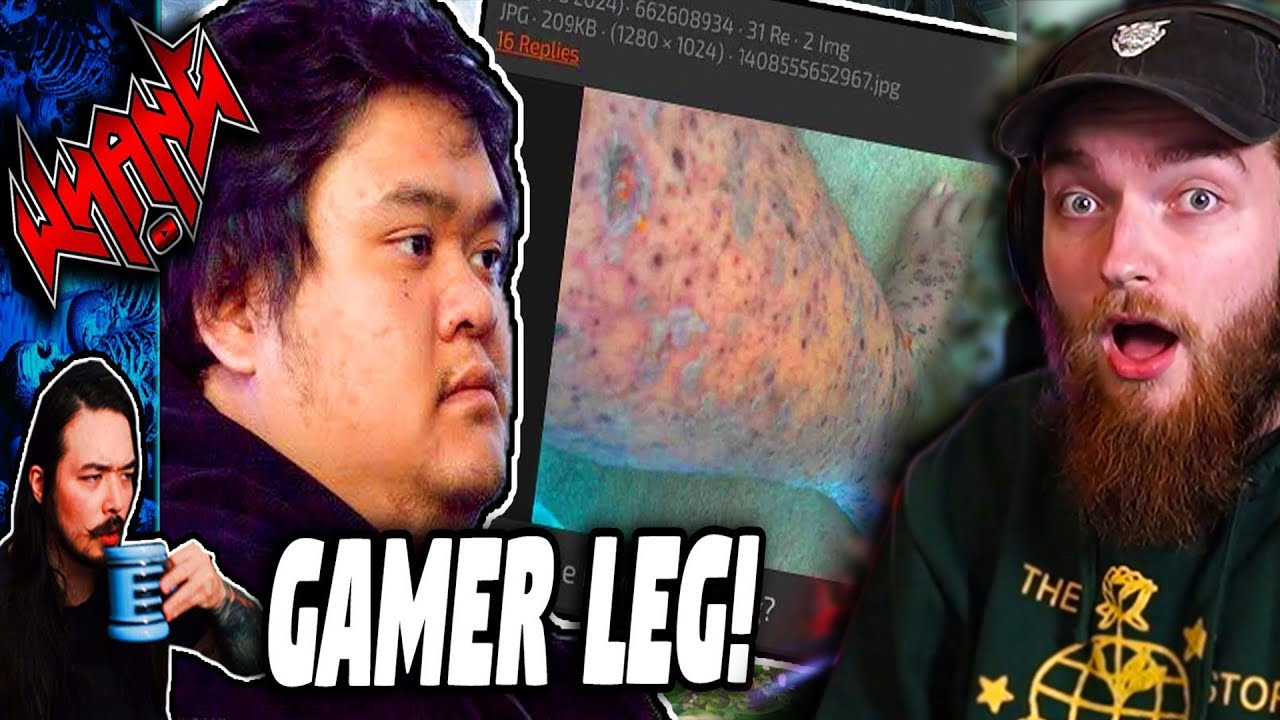 Gamer Leg! - Tales From the Internet | Chrissy Reacts - YouTube