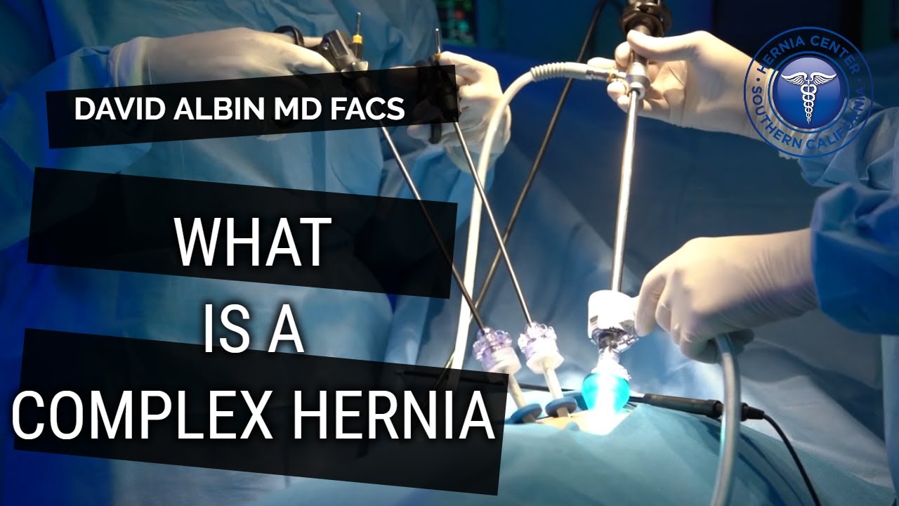 What are complex hernias? Explained by David Albin, M.D. F.A.C.S. - YouTube