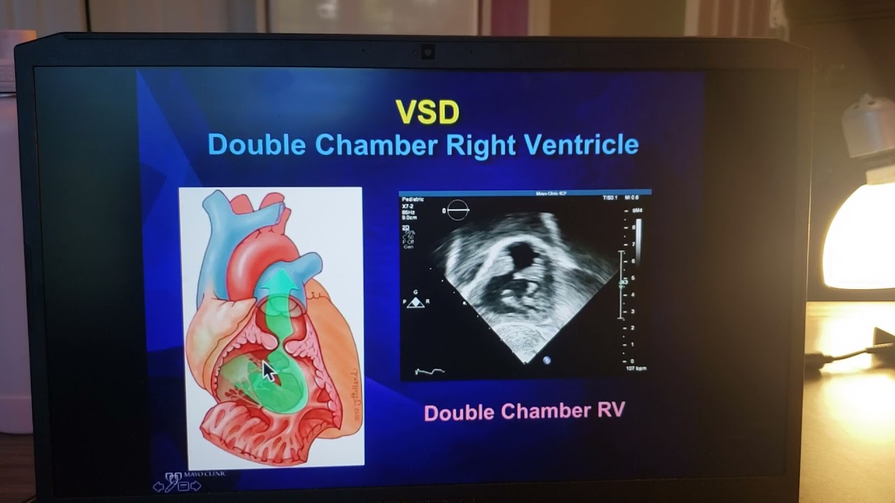 Double outlet RV - YouTube