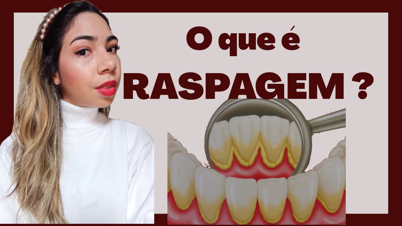 O QUE É RASPAGEM NO DENTISTA? - YouTube