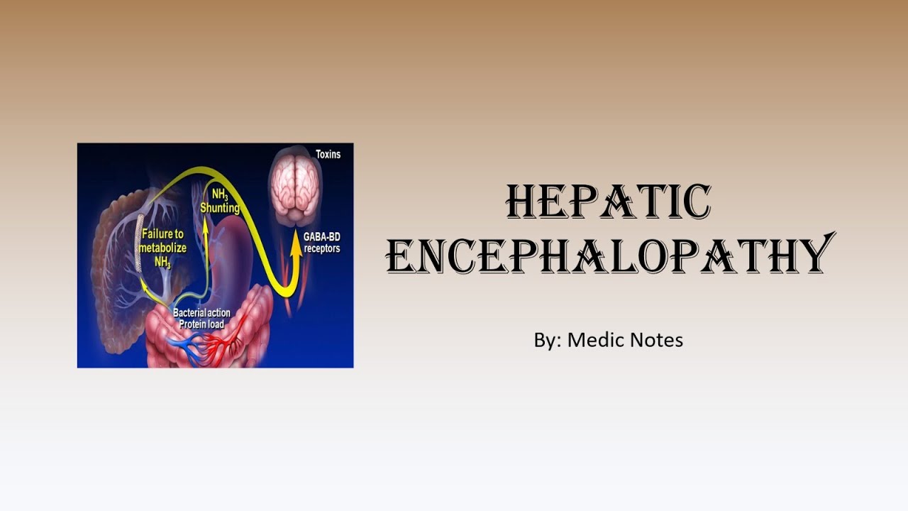 Hepatic encephalopathy - causes, pathophysiology, sign value - YouTube