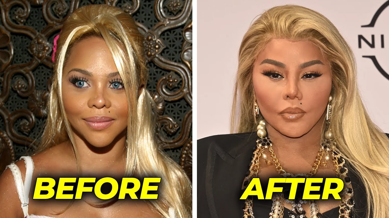 The Truth on Lil Kims Insane Transformation - YouTube