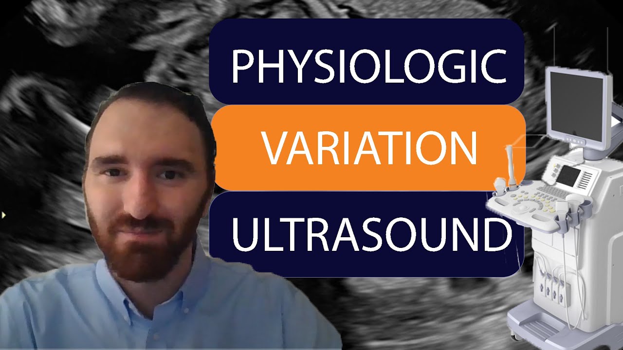 Integrating Physiologic Variation and Control into Ultrasound Training ...