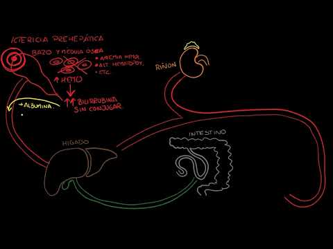 La ictericia prehepática - YouTube