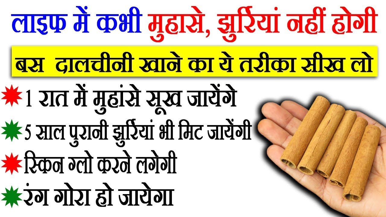 मुंहासों का इलाज, पिंपल्स हटाने के उपाय, Muhase Ke Liye Gharelu Upay ...