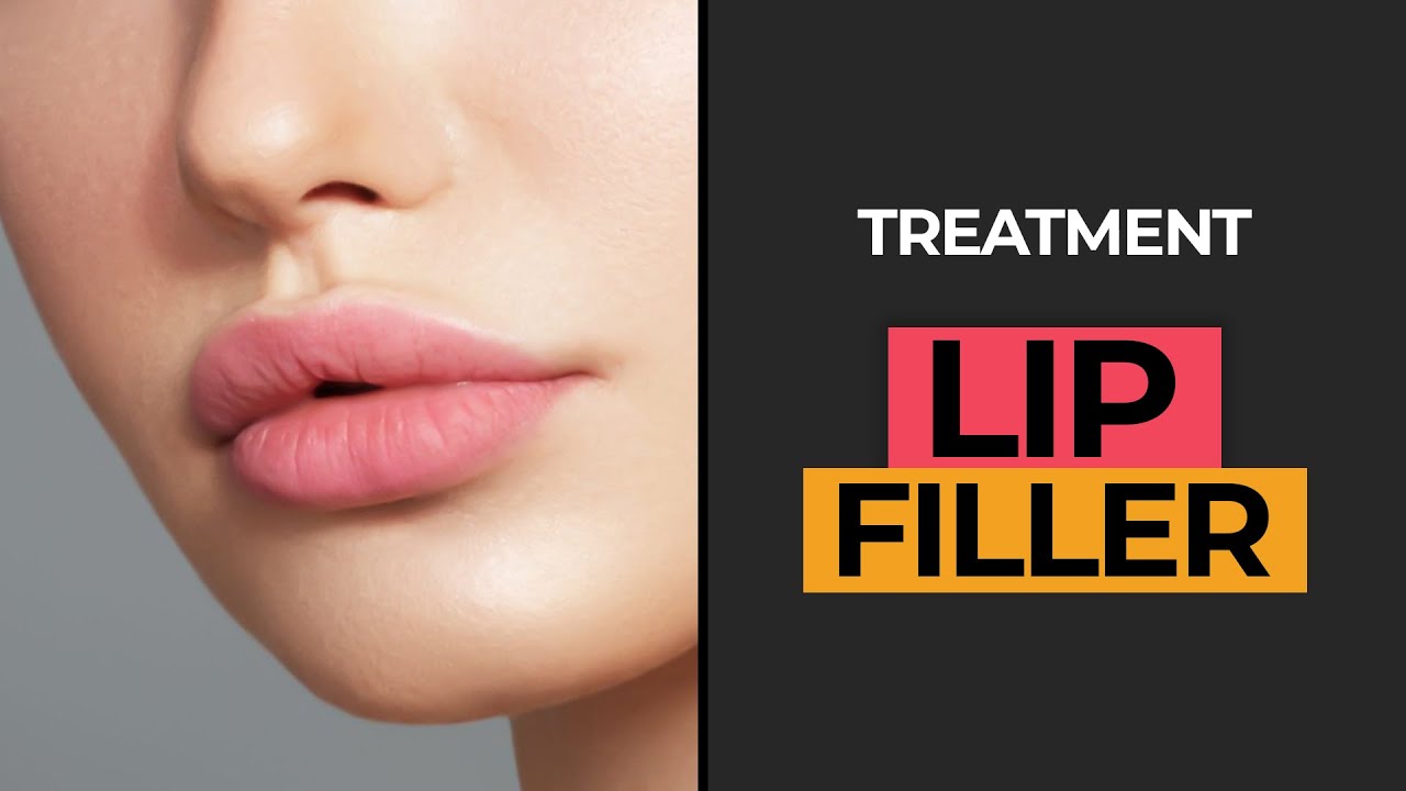 LIP FILLERS of Miss Noor - Russain Lips / Pouty Lips - HASH CLINICS ...