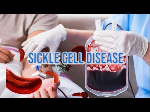 PREVENTION OF Sickle Cell Disease - YouTube