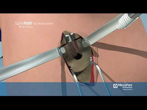 SuperPath huefte24 de Animationsvideo - YouTube