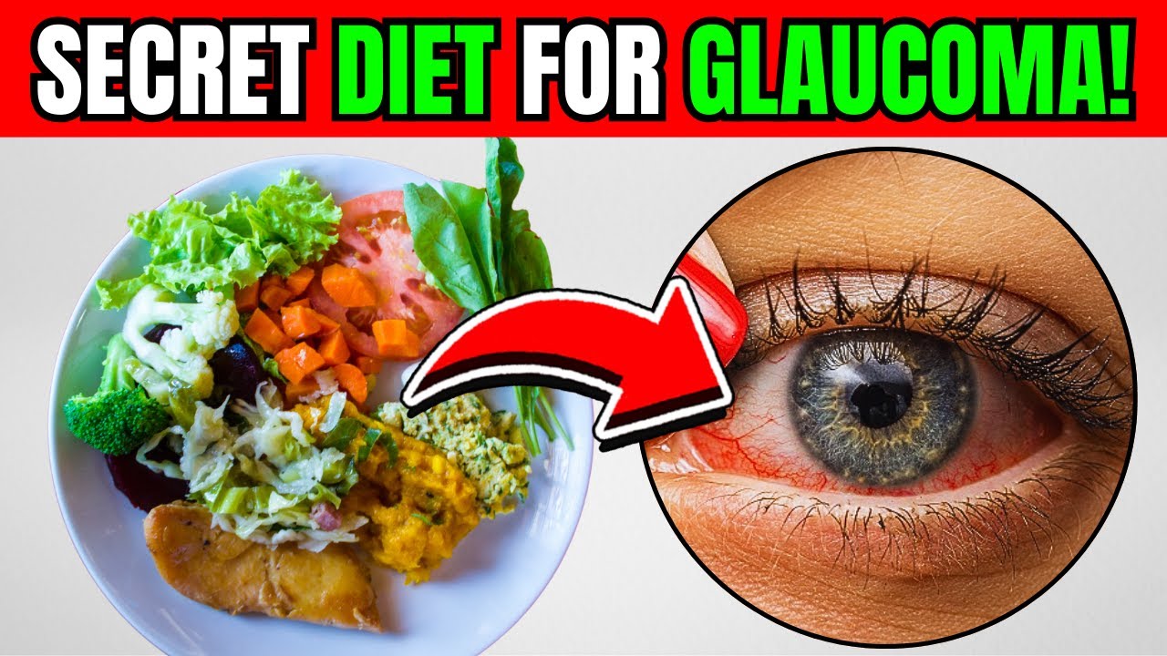 The GLAUCOMA Diet: Foods to Eat and Avoid to Protect Your Vision - YouTube