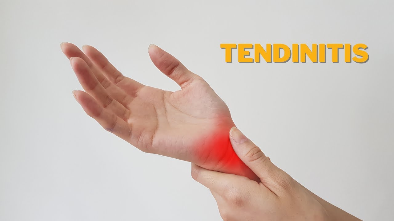 What is Tendinitis and how do you fix it?? - YouTube